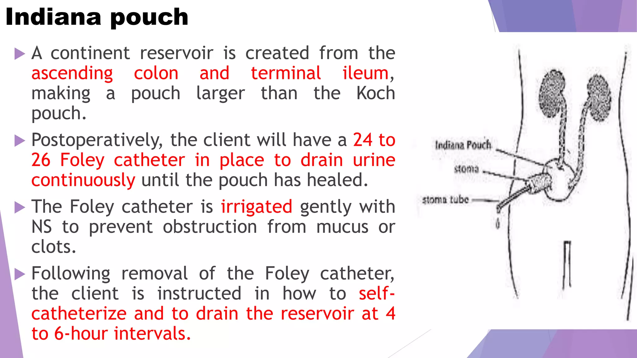 Bladder cancer and its management | PPTX