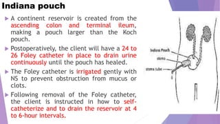 Bladder cancer and its management | PPTX