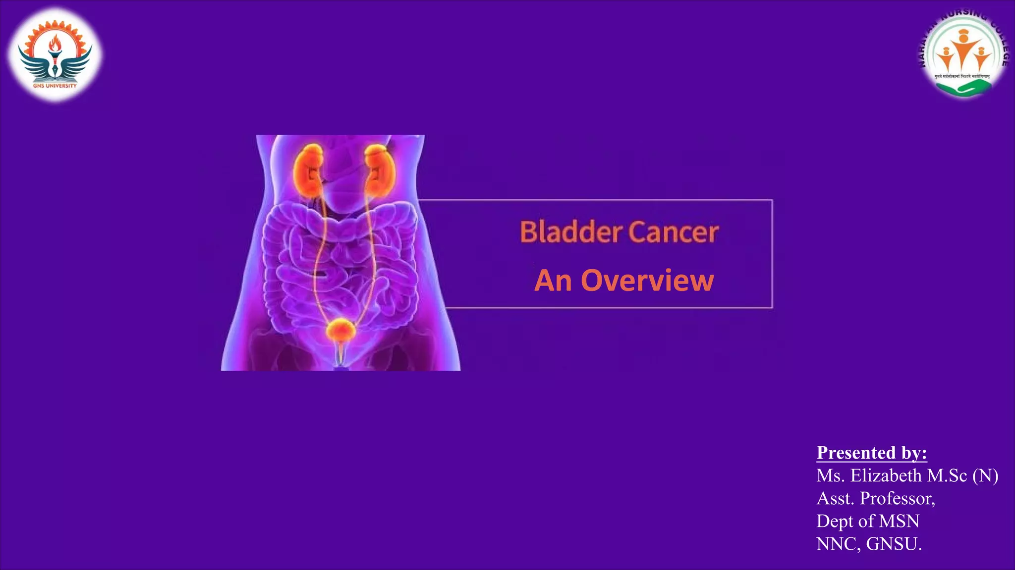 Bladder cancer | PDF