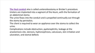 Bladder cancer | PDF