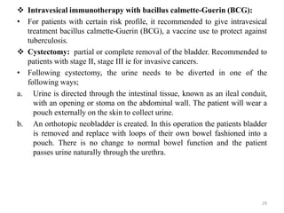 Bladder cancer.pptx