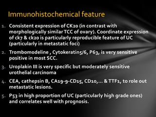 Bladder Cancer 7.ppt