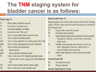 Bladder cancer | PPTX