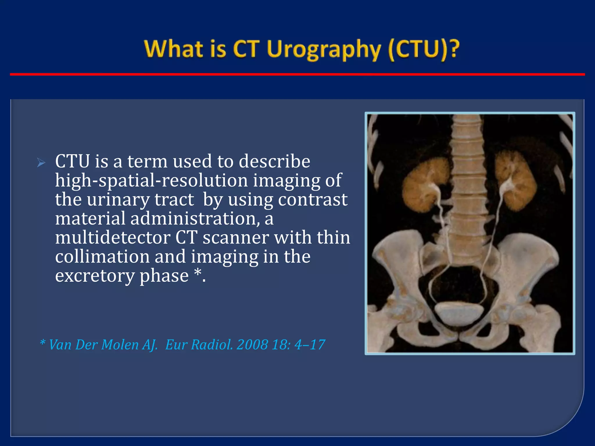 Role of CT Urography in bladder cancer. Cambridge lecture. | PPTX