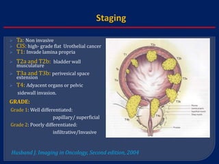Role of CT Urography in bladder cancer. Cambridge lecture. | PPTX