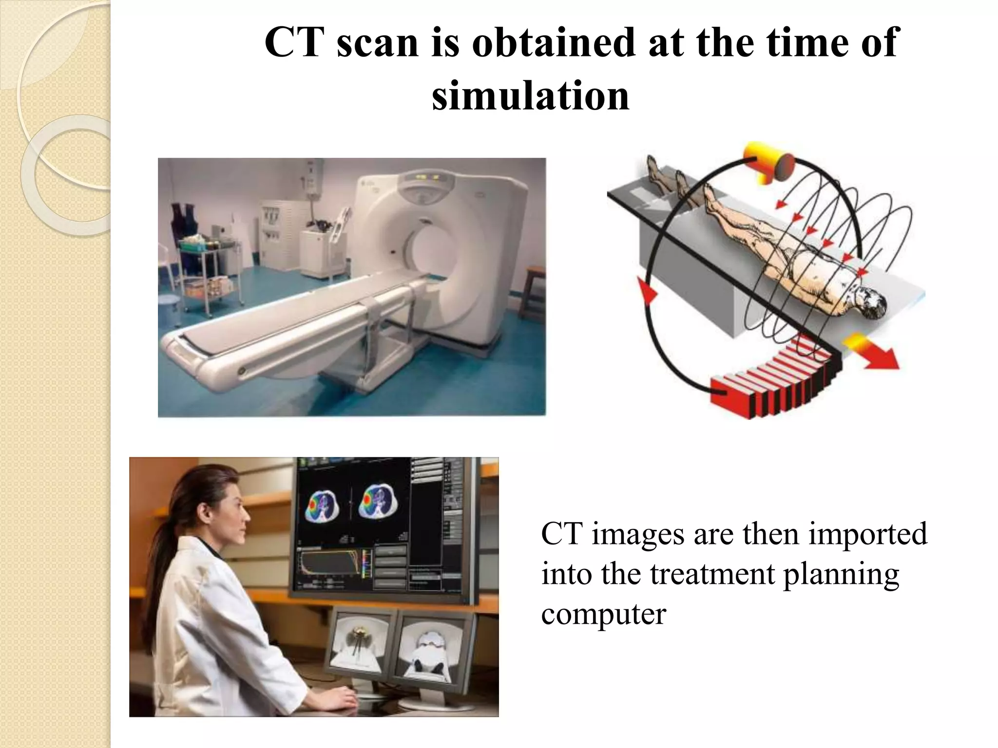 Radiation for the Treatment of Bladder Cancer | PPTX