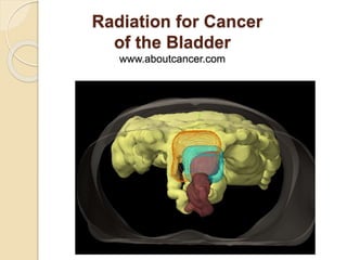 Radiation for the Treatment of Bladder Cancer | PPT