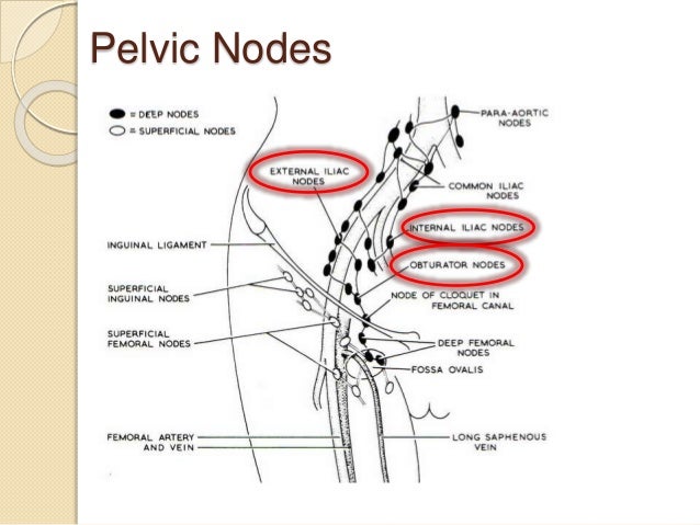 Radiation for the Treatment of Bladder Cancer