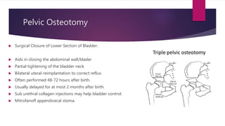 Bladder exstrophy | PPTX