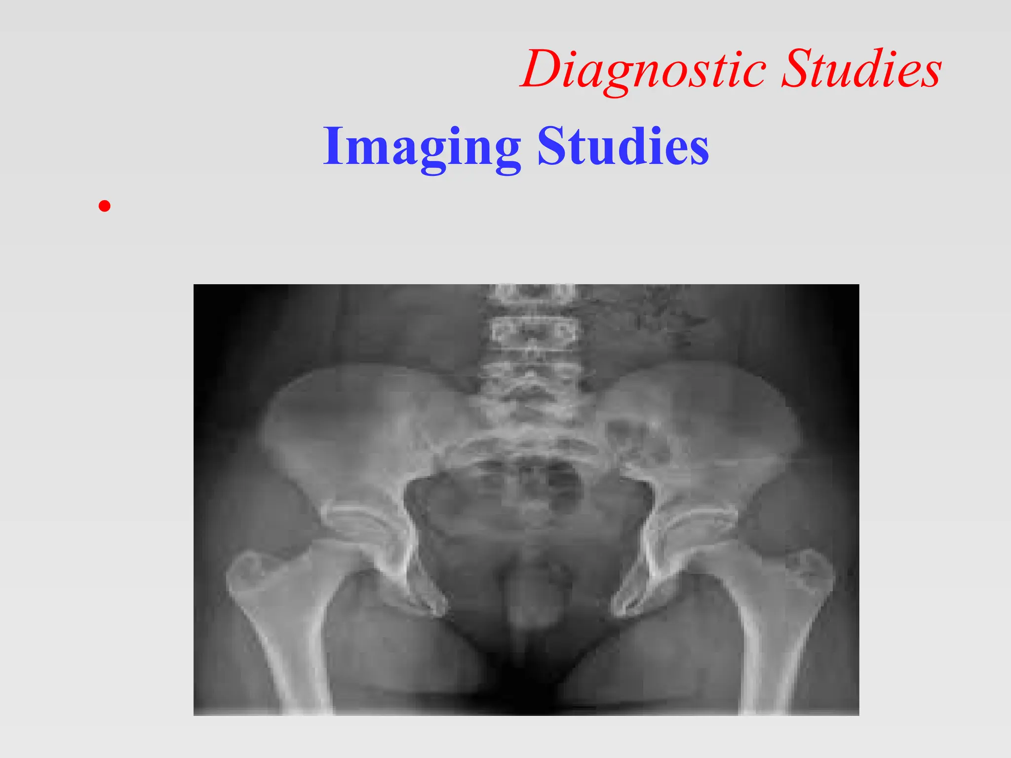 Bladder Exstrophy Epispadias Complex .pptx