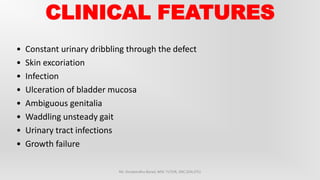 Bladder exstrophy or ectopia vescica | PPTX