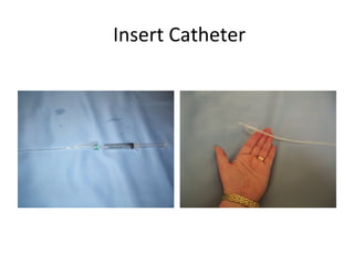 Bladder filling equipment | PPT