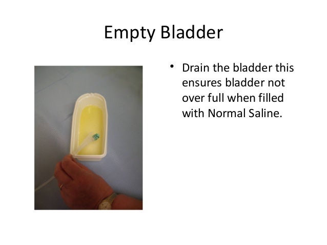Bladder filling equipment