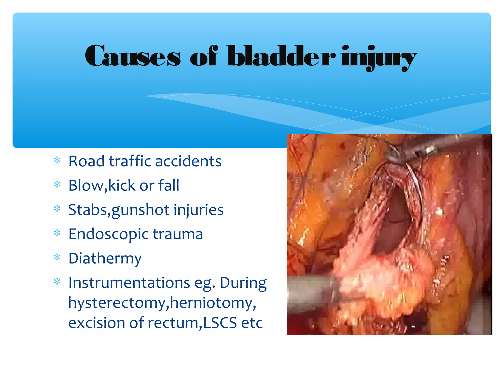 Bladder injury by dhanush | PPT