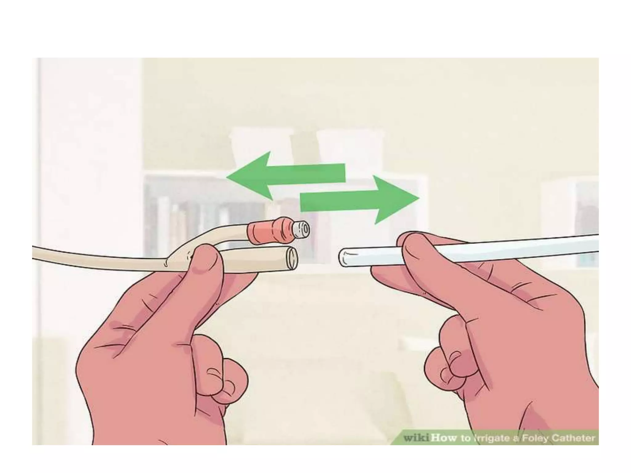 Bladder irrigation | PPTX