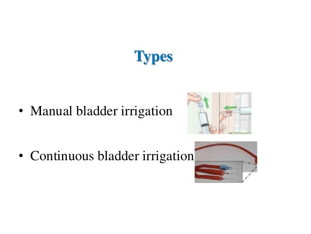 Bladder irrigation