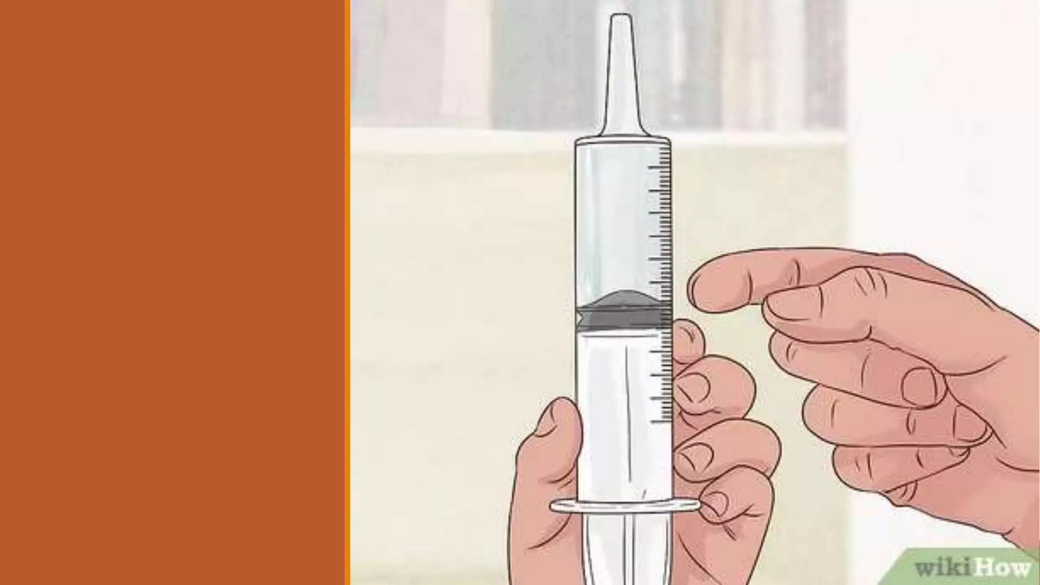 Bladder irrigation | PPTX