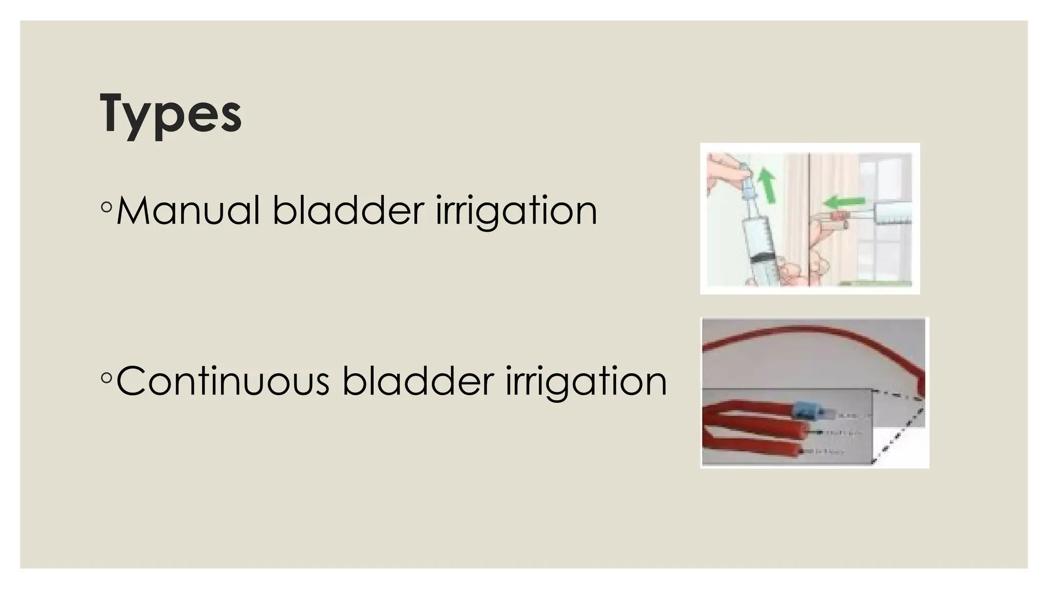 Procedures of Bladder Irrigation.pptx