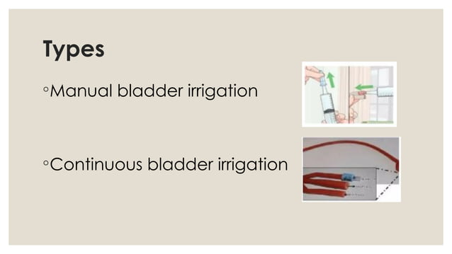 Procedures of Bladder Irrigation.pptx | First Aid | Injuries