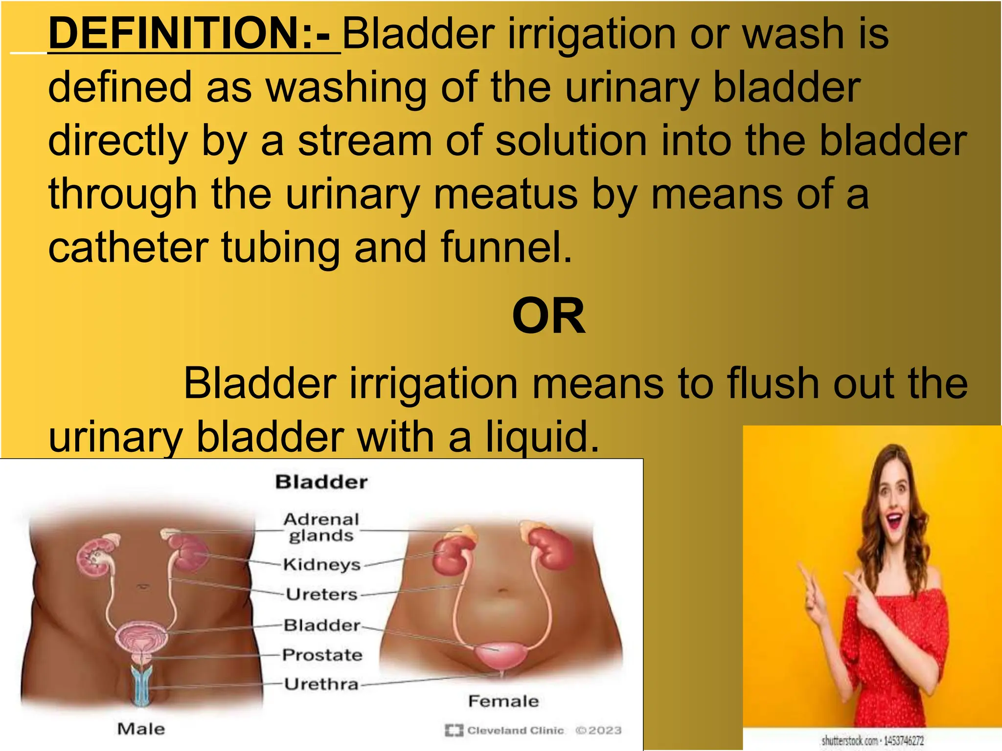 BLADDER_IRRIGATION[1] Mr. Tarique. 23.pptx