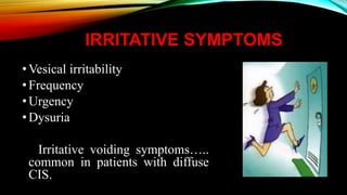 Bladder mass clinical features & staging | PPTX