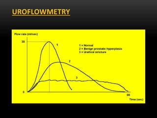 Bladder outflow obstruction.ppt