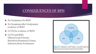 BLADDER OUTFLOW OBSTRUCTION(BOO) PPT.pptx