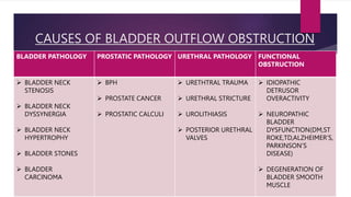 BLADDER OUTFLOW OBSTRUCTION(BOO) PPT.pptx