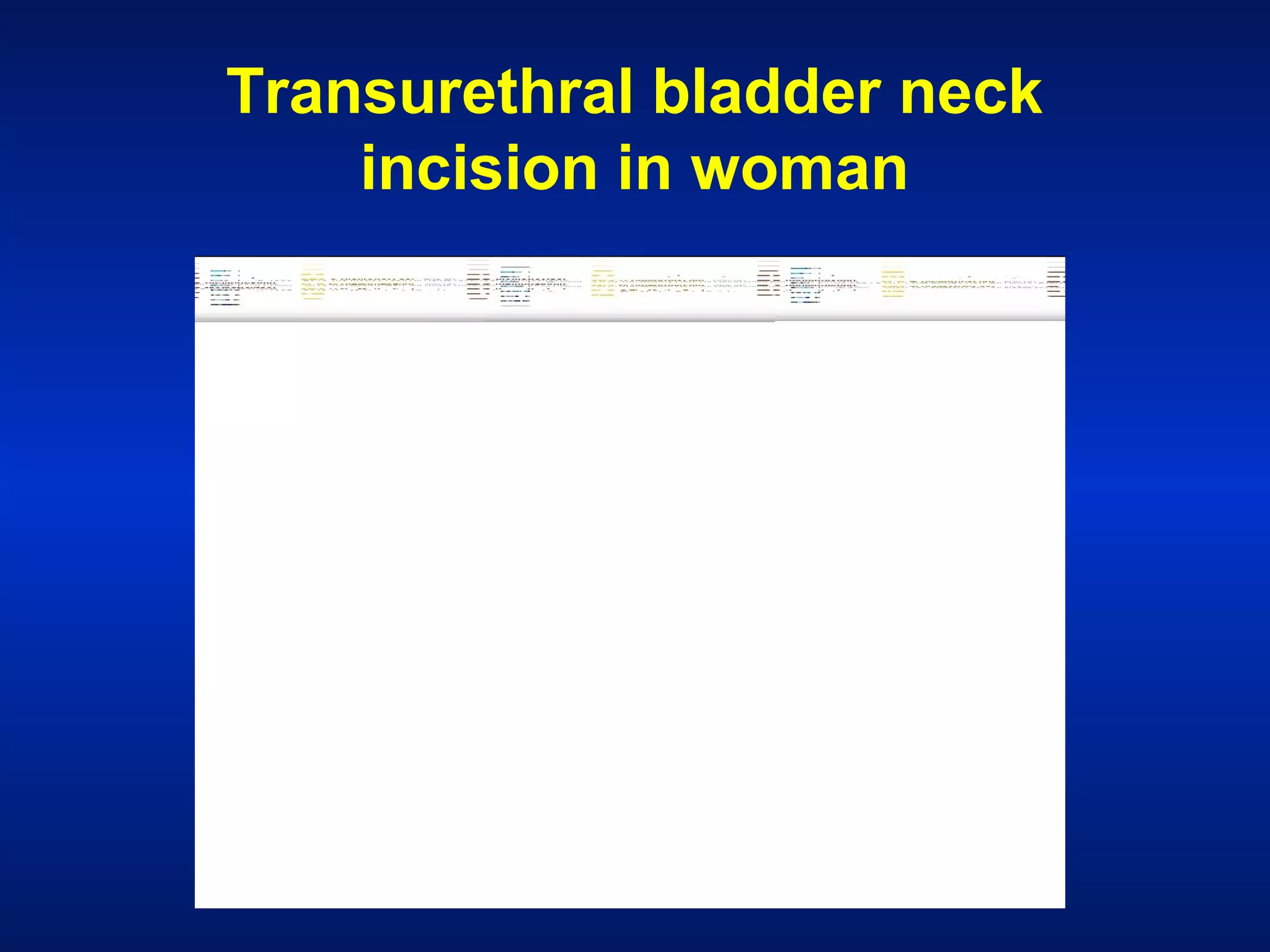 Bladder Outlet Obstruction in Women - Diagnostics and Therapy | PPT