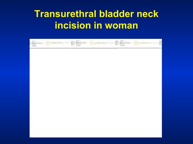 Bladder Outlet Obstruction in Women - Diagnostics and Therapy | PPT