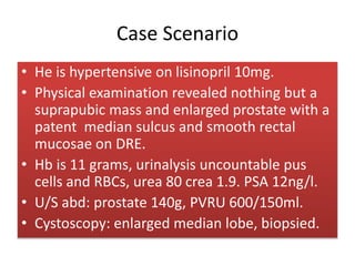 Bladder Outlet Obstruction (BOO).pptx