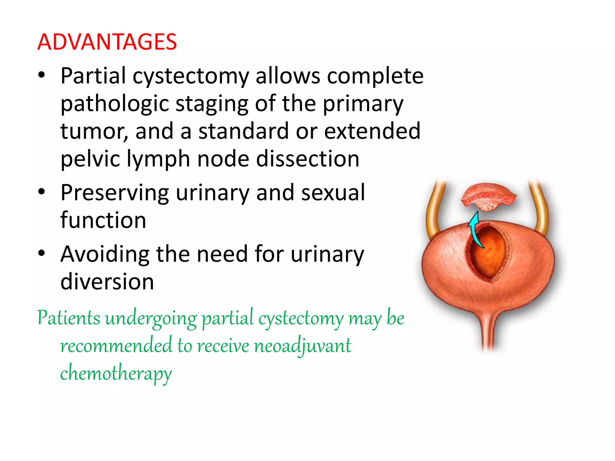 Bladder preservation in carcinoma of bladder | PPTX