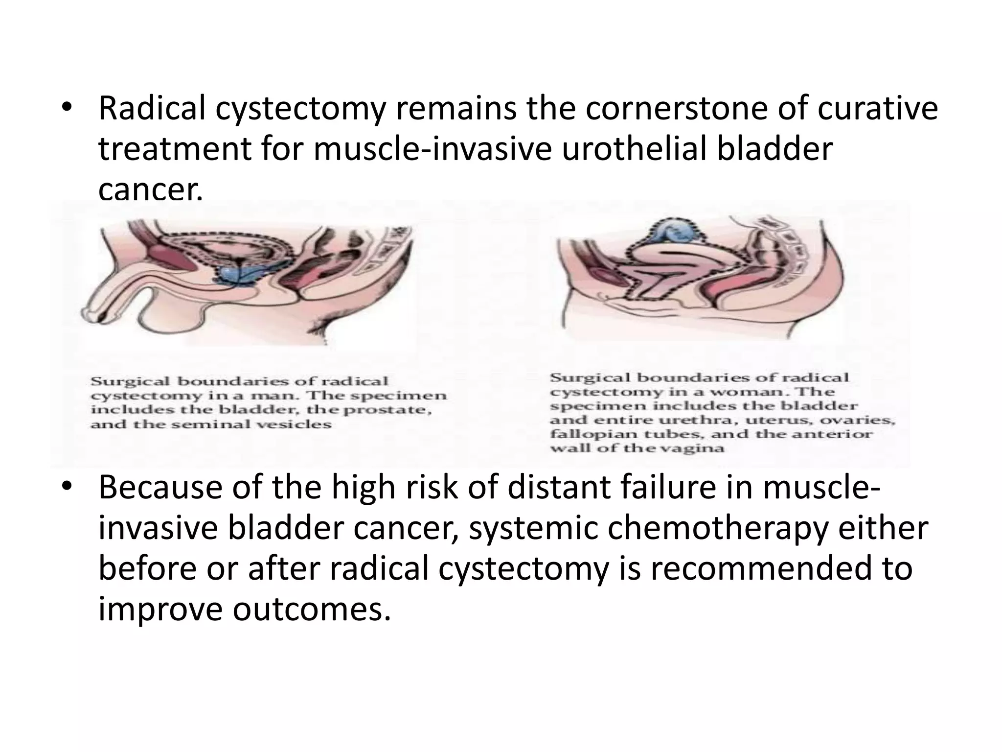 Bladder preservation in carcinoma of bladder | PPTX