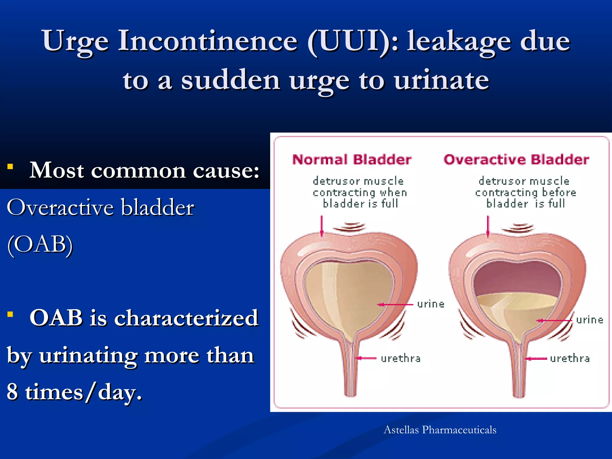 Bladder Retraining | PPT