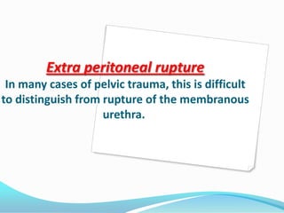 urology.Bladder rupture,urine retention.(dr.ali kamal) | PPTX