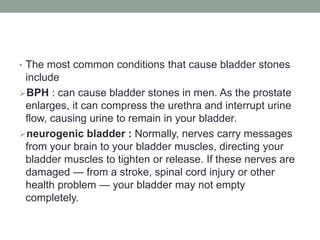 Bladder stones | PPTX