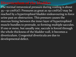 Bladder stones,fistula,diverticulum | PPTX | Digestive Disorders ...