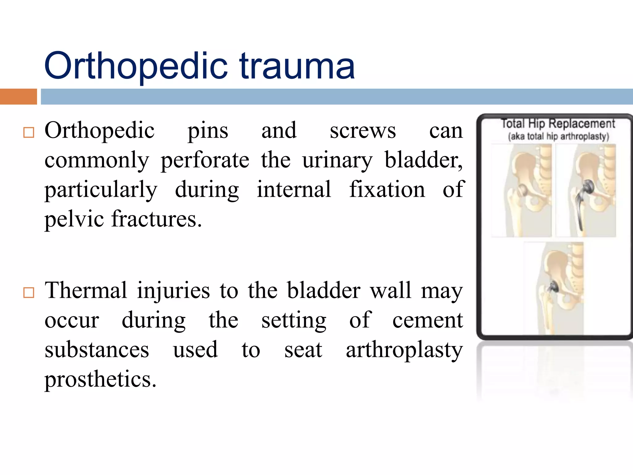 bladder trauma.ppt
