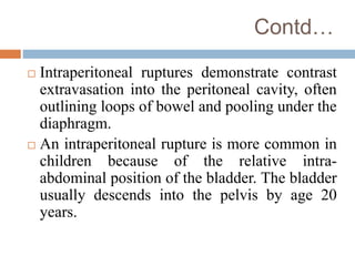 bladder trauma.ppt