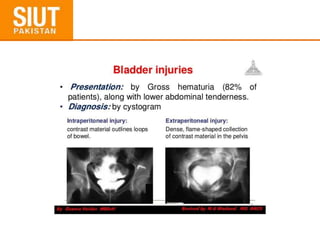 Bladder trauma ff.pptx