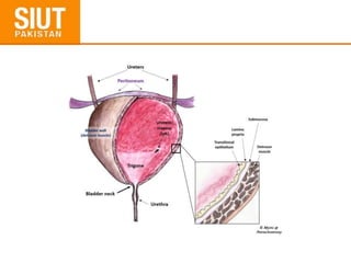 Bladder trauma ff.pptx