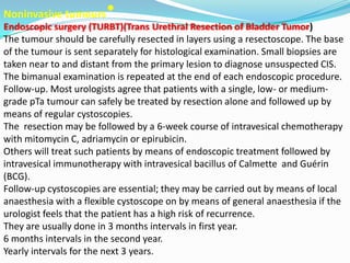 Bladder tumor | PPTX