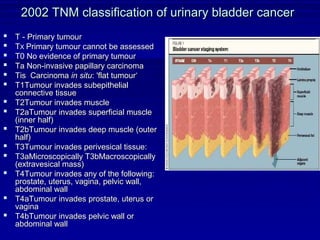 Blader cancer | PPT