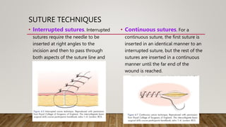 Blades Needle and Suture short presentation | PPTX