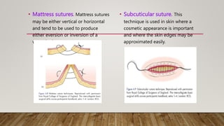 Blades Needle and Suture short presentation | PPTX