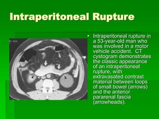 bladtr [EDocFind.com].ppt