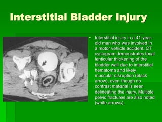 bladtr [EDocFind.com].ppt