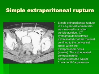 bladtr [EDocFind.com].ppt