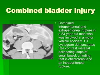 bladtr [EDocFind.com].ppt