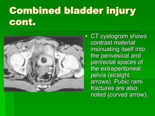 bladtr [EDocFind.com].ppt